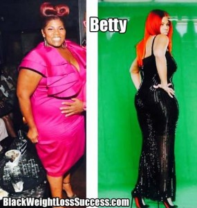 Betty lost 166 pounds with weight loss surgery | Black Weight Loss Success