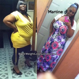 Martine lost 122 pounds with surgery | Black Weight Loss Success