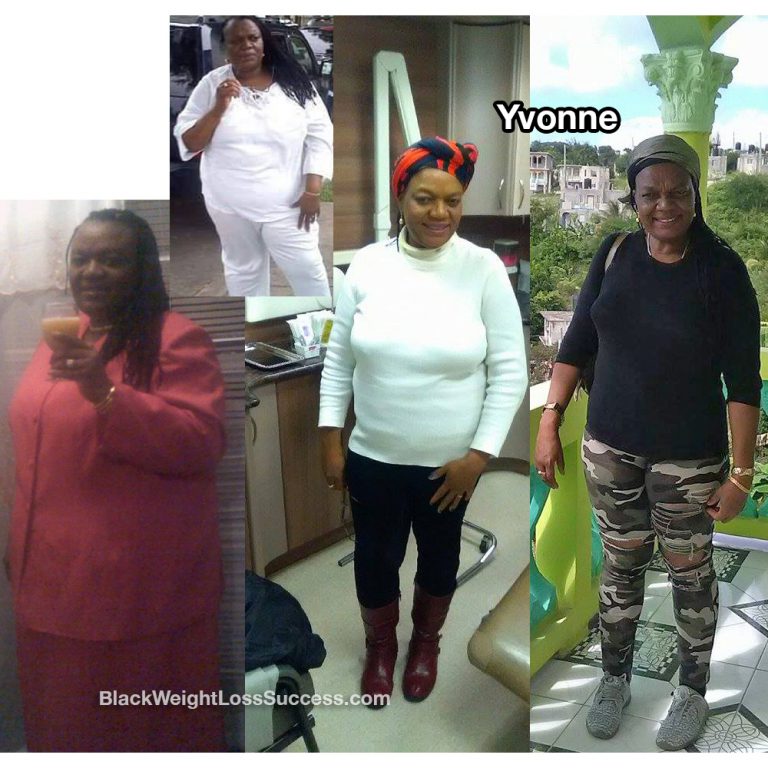 Yvonne lost 91 pounds - Black Weight Loss Success