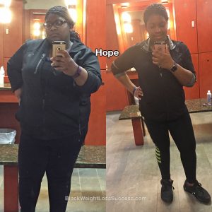 Hope lost 134 pounds | Black Weight Loss Success