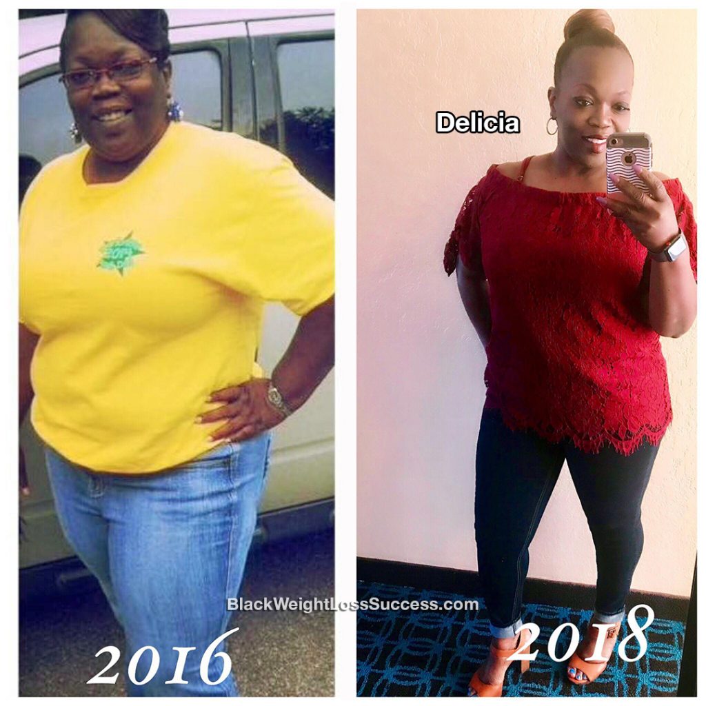 Delicia lost 103 pounds | Black Weight Loss Success