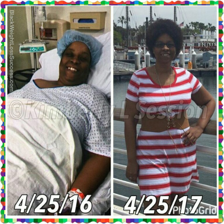 Kimberly lost 161 pounds | Black Weight Loss Success