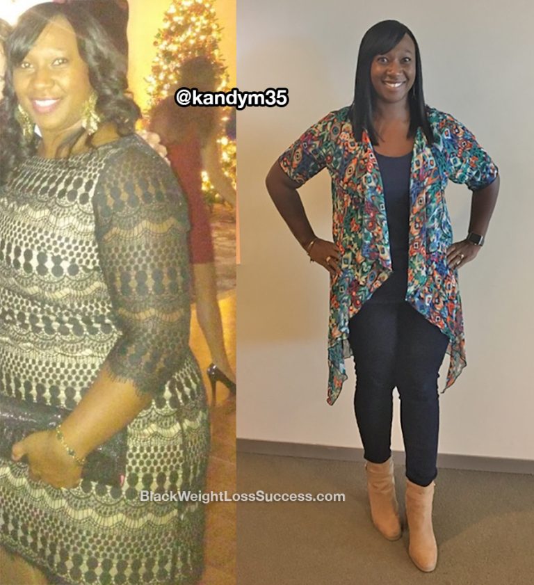Kandy lost 62 pounds | Black Weight Loss Success