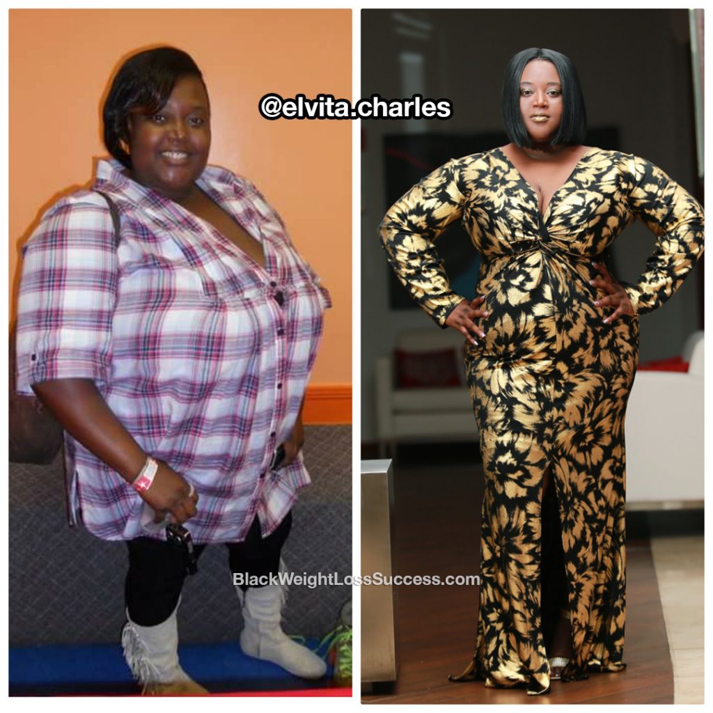 Elvita lost 43 pounds | Black Weight Loss Success