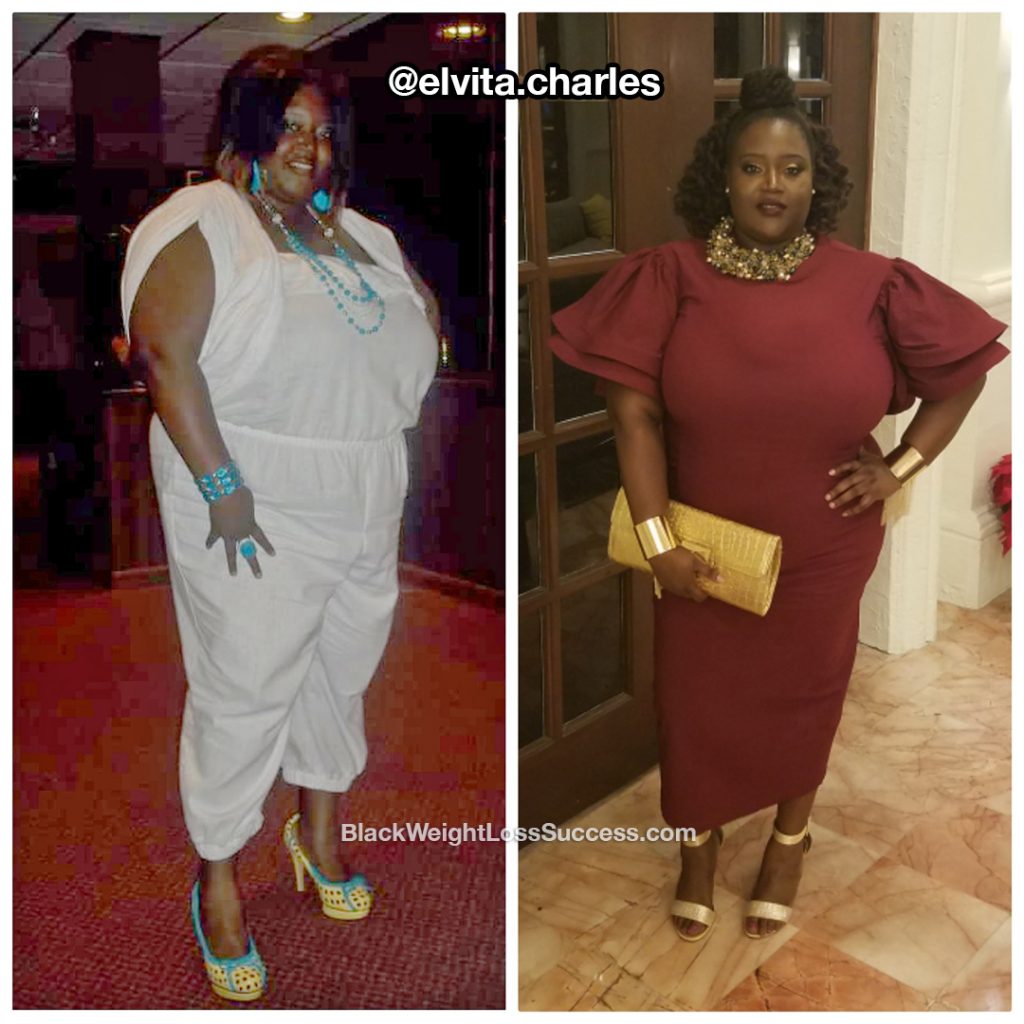 Elvita lost 43 pounds | Black Weight Loss Success