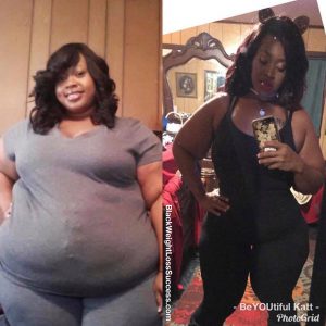 Katt lost 146 pounds - Black Weight Loss Success
