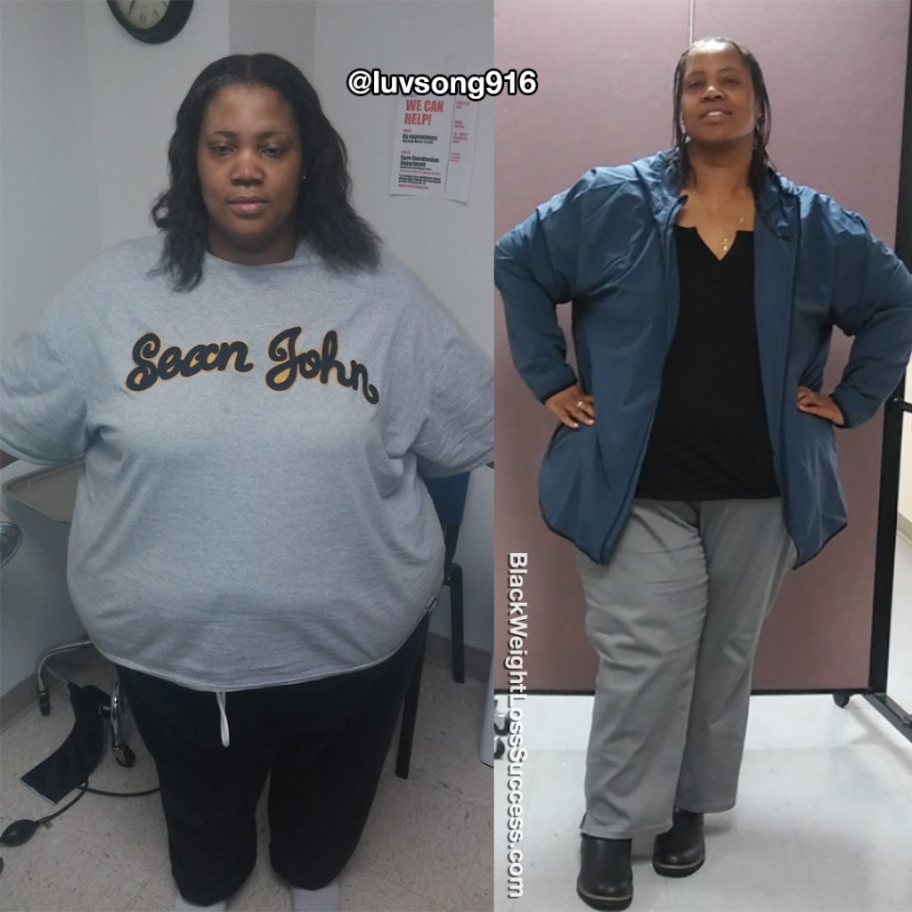 Song lost 157 pounds - Black Weight Loss Success