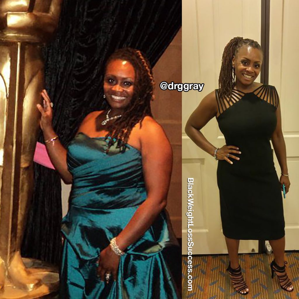 Dr. Geneva lost 50 pounds - Black Weight Loss Success