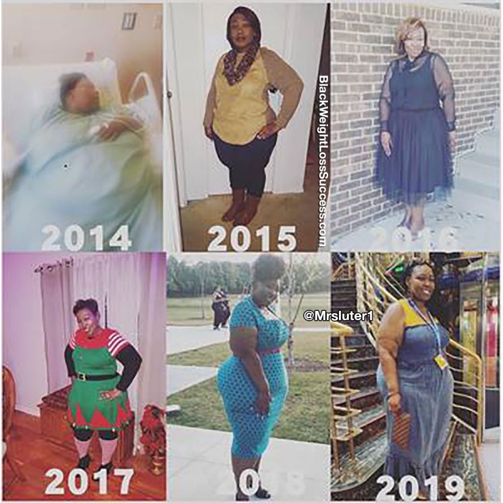 Martha lost 158 pounds - Black Weight Loss Success