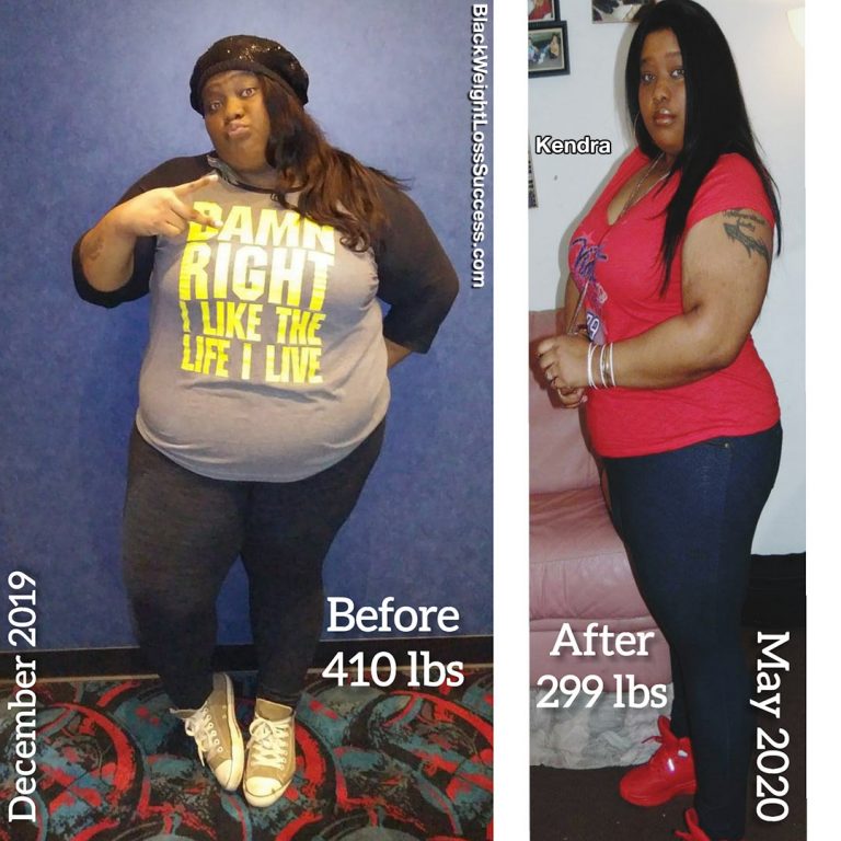 Kendra lost 137 pounds - Black Weight Loss Success