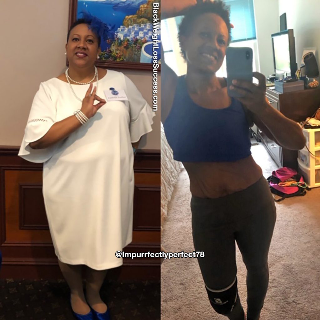 Kimberlyn lost 130 pounds - Black Weight Loss Success