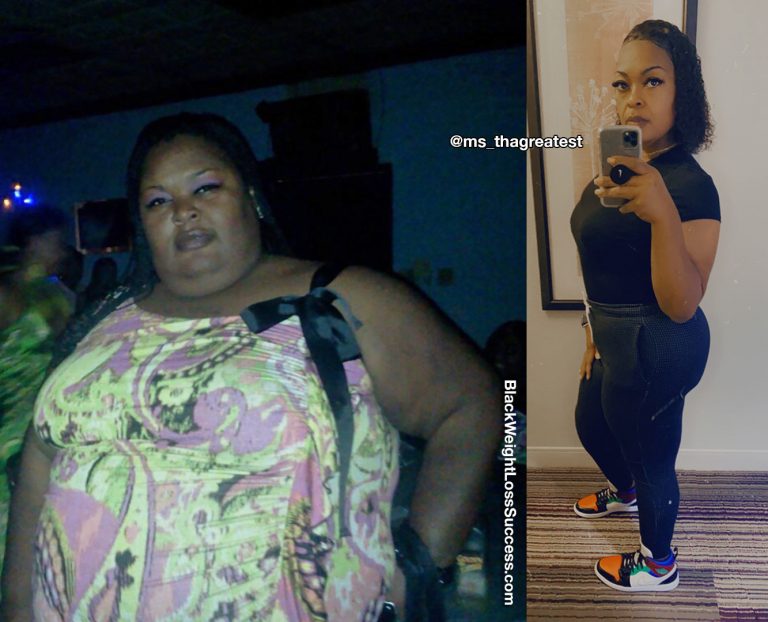 LaShunta lost 260 pounds - Black Weight Loss Success