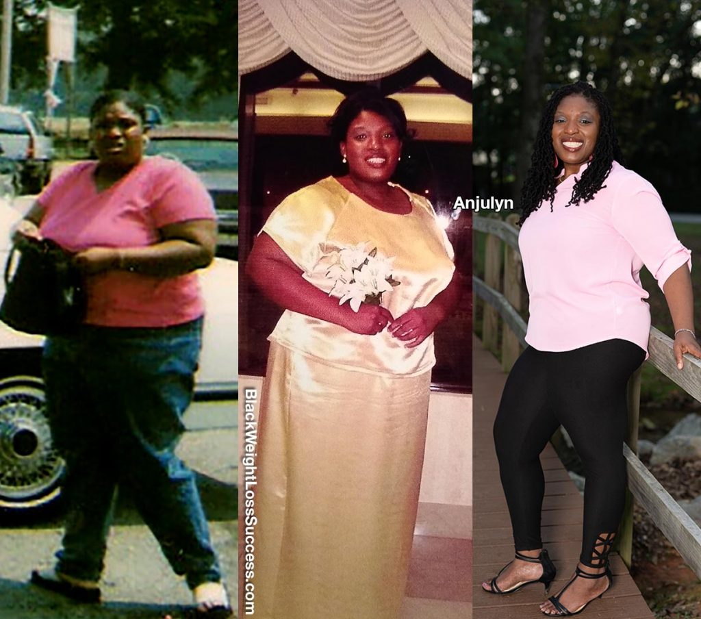 Anjulyn lost 78 pounds - Black Weight Loss Success