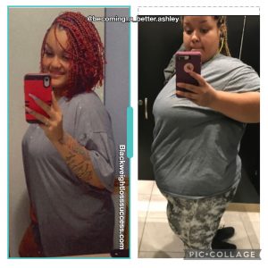 Ashley lost 215 pounds - Black Weight Loss Success