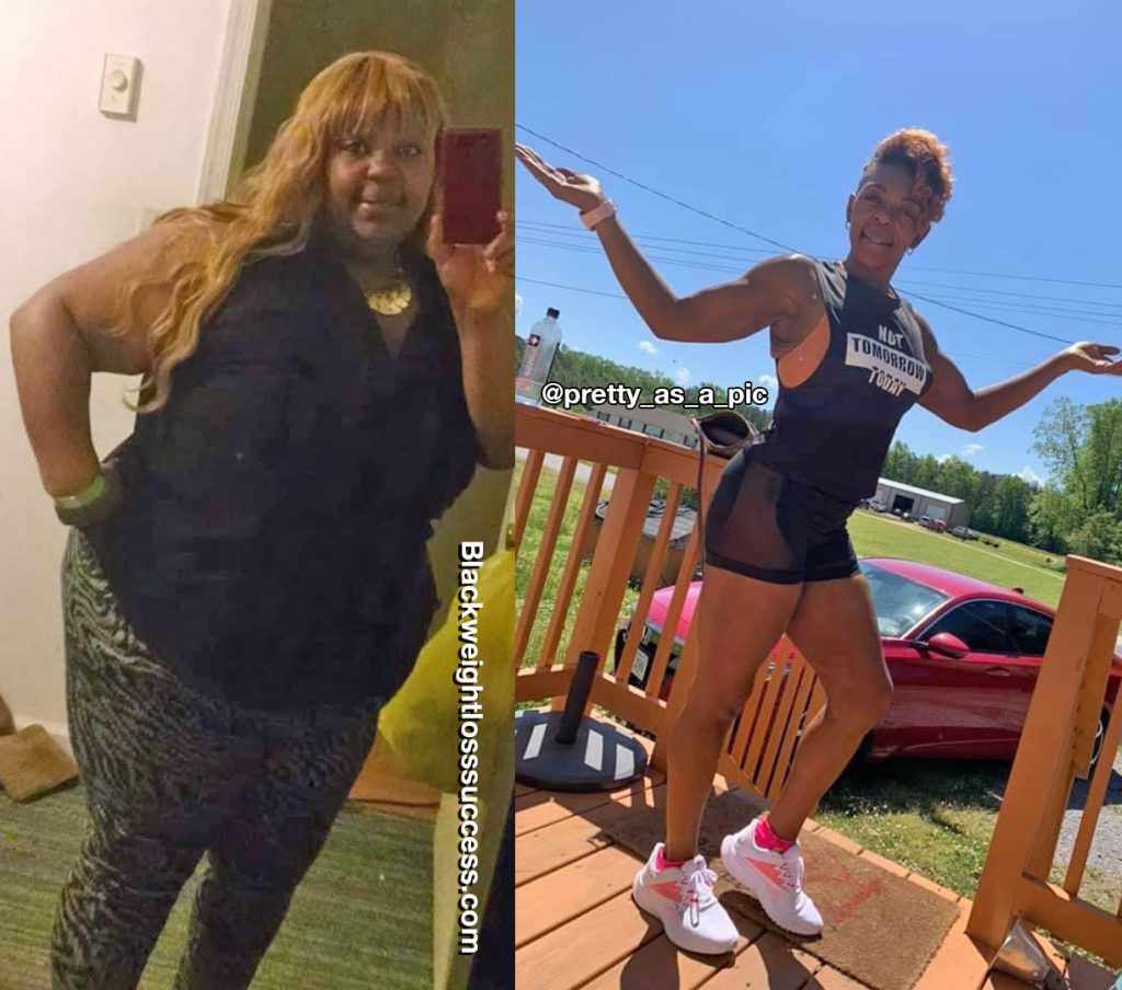 Sharna’ lost 190 pounds - Black Weight Loss Success