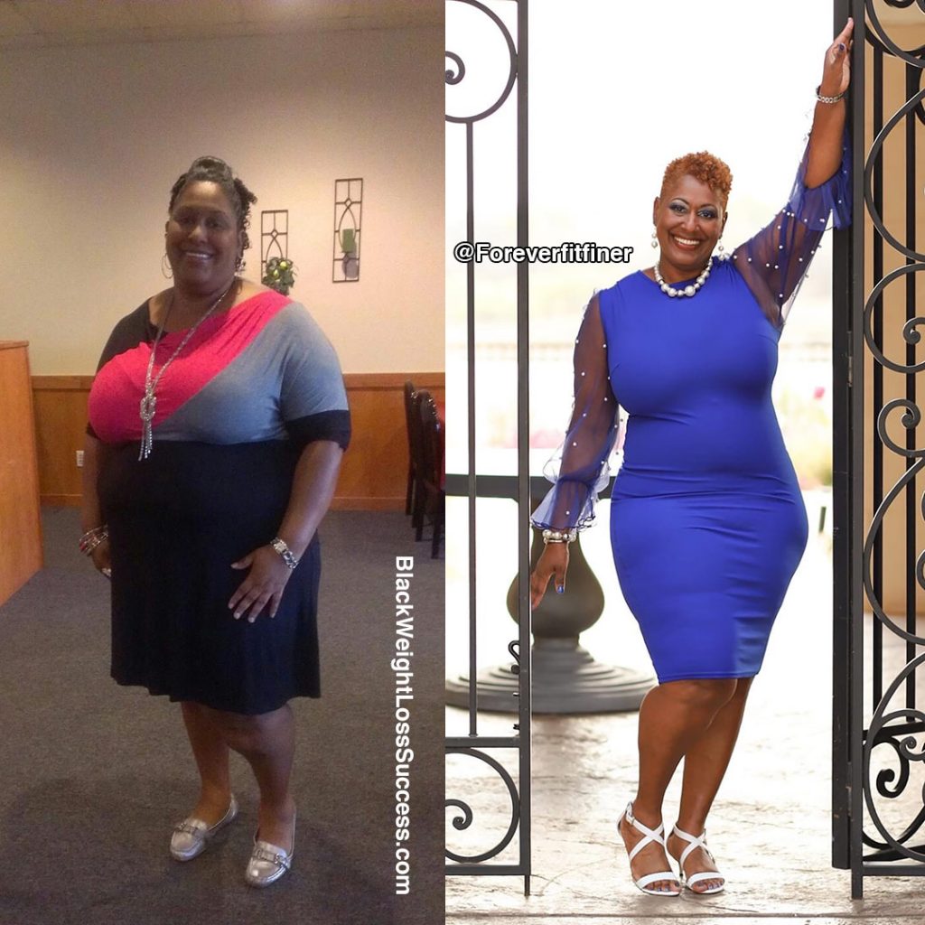 Latonya lost 101 pounds - Black Weight Loss Success