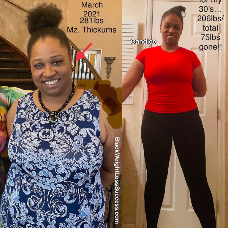 Candice lost 75 pounds - Black Weight Loss Success