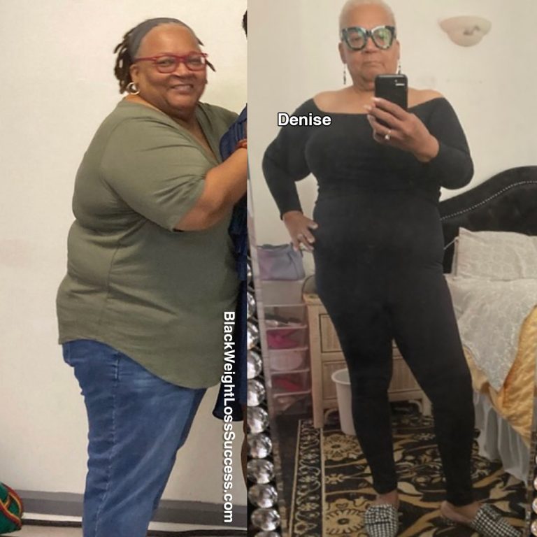 Denise lost 75 pounds - Black Weight Loss Success