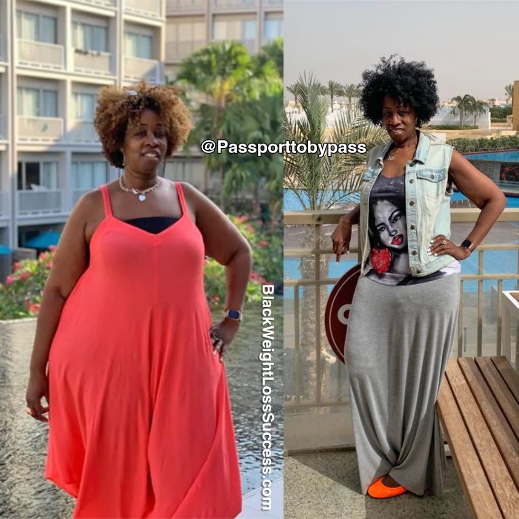 Kamara lost 115 pounds - Black Weight Loss Success
