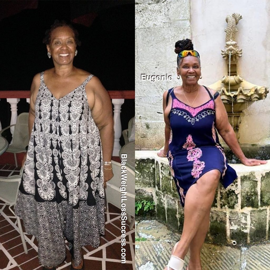Eugenie lost 106 pounds | Black Weight Loss Success
