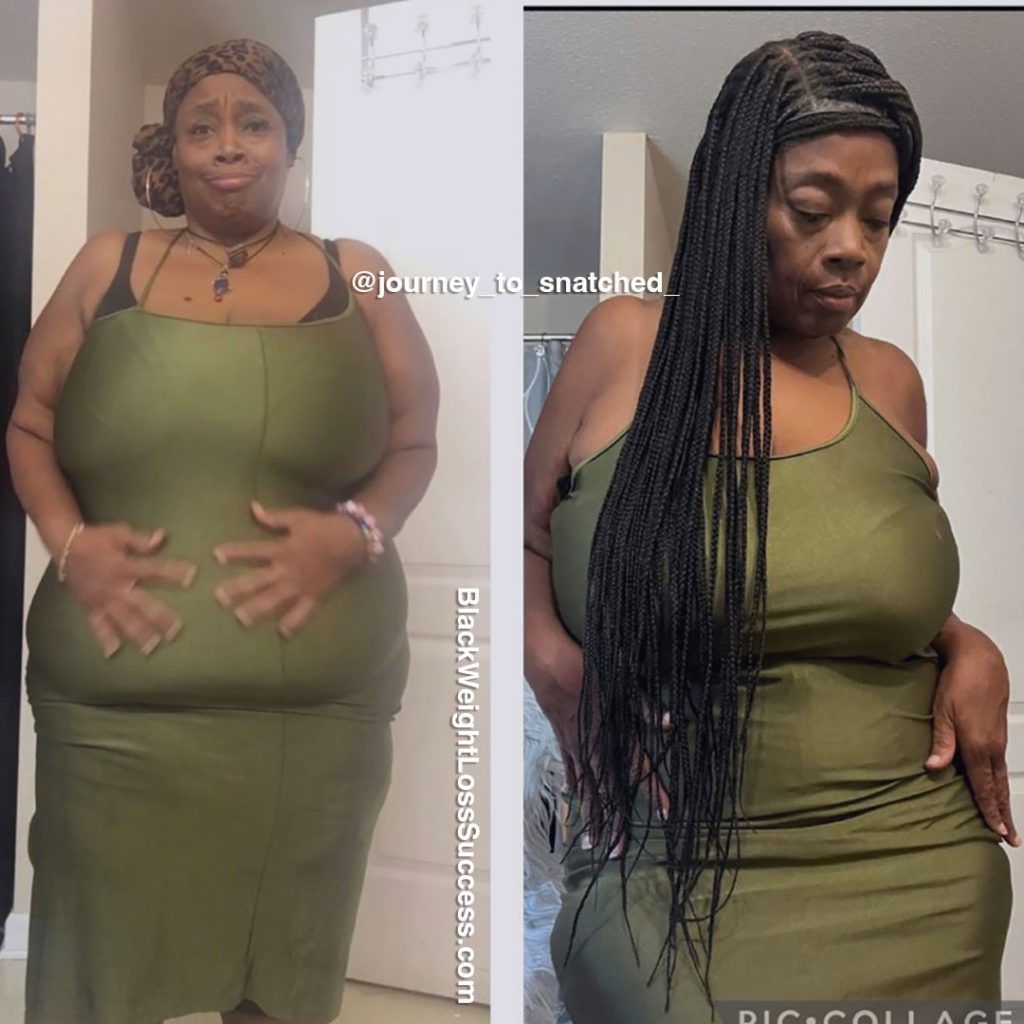 Mary lost 291 pounds - Black Weight Loss Success