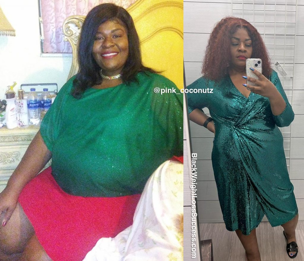 Woodlyne lost 68 pounds - Black Weight Loss Success