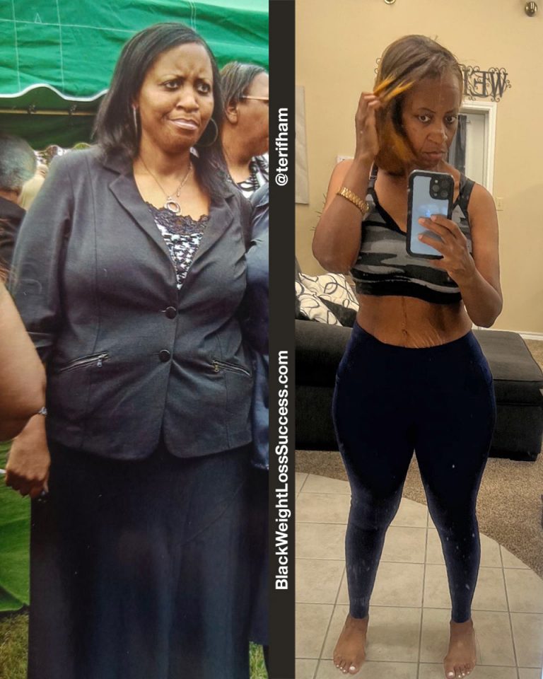 Teri’ lost 116 pounds | Black Weight Loss Success